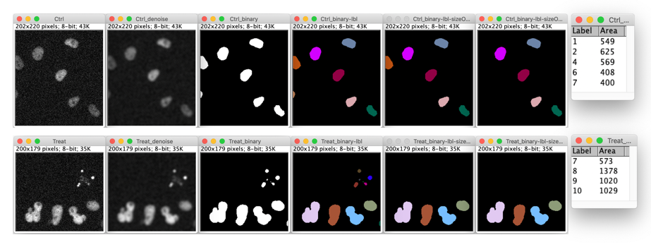 Workflow 2d Noisy Object Segmentation And Filtering Image Analysis 9674